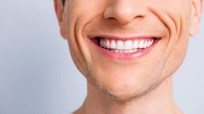 Dokter Gigi Jabarkan Proses Depigmentasi Gingiva atau Gusi, Begini ...