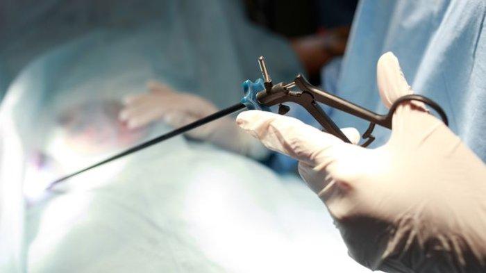 Dokter Spesialis Bedah Jelaskan Gejala Radang Usus Buntu - TribunHealth.com