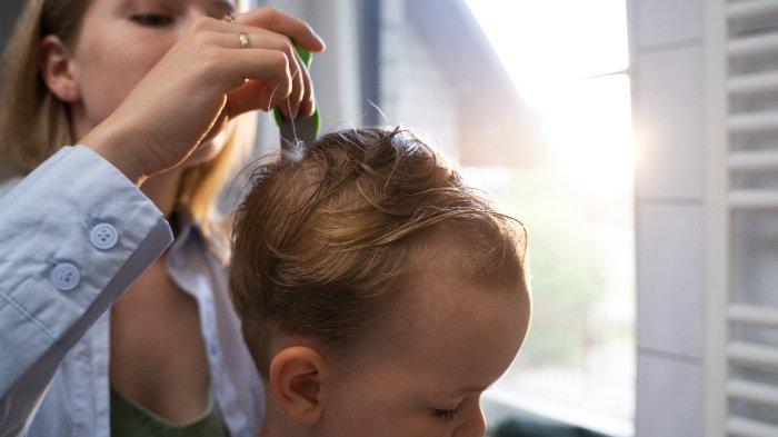 6 Minyak Rambut Bayi Terbaik, Jaga Kesehatan Kulit Kepala dan Rambut Si ...
