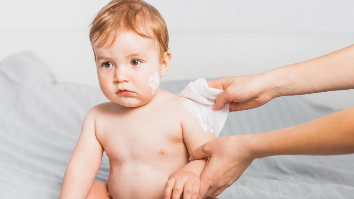 6 Pilihan Tisu Basah Bayi Non Alkohol dan Bebas Parfum - TribunHealth.com