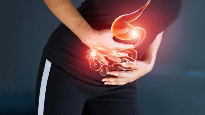 Dokter Spesialis Bedah Jelaskan Gejala Radang Usus Buntu - TribunHealth.com